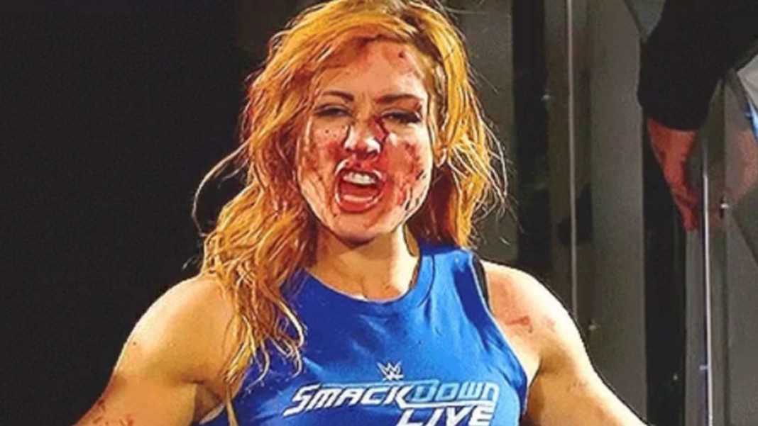 She Broke My Nose And Sent Me Flowers Becky Lynch Recalls When Wwe