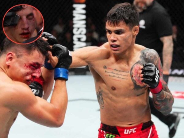 WATCH: Coach BIZARELY says 'you don't need your eyes' to damaged ...