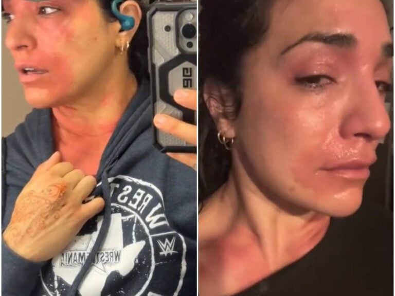 WATCH: GRAPHIC WARNING! Raquel Rodriguez shares gut-wrenching video of ...